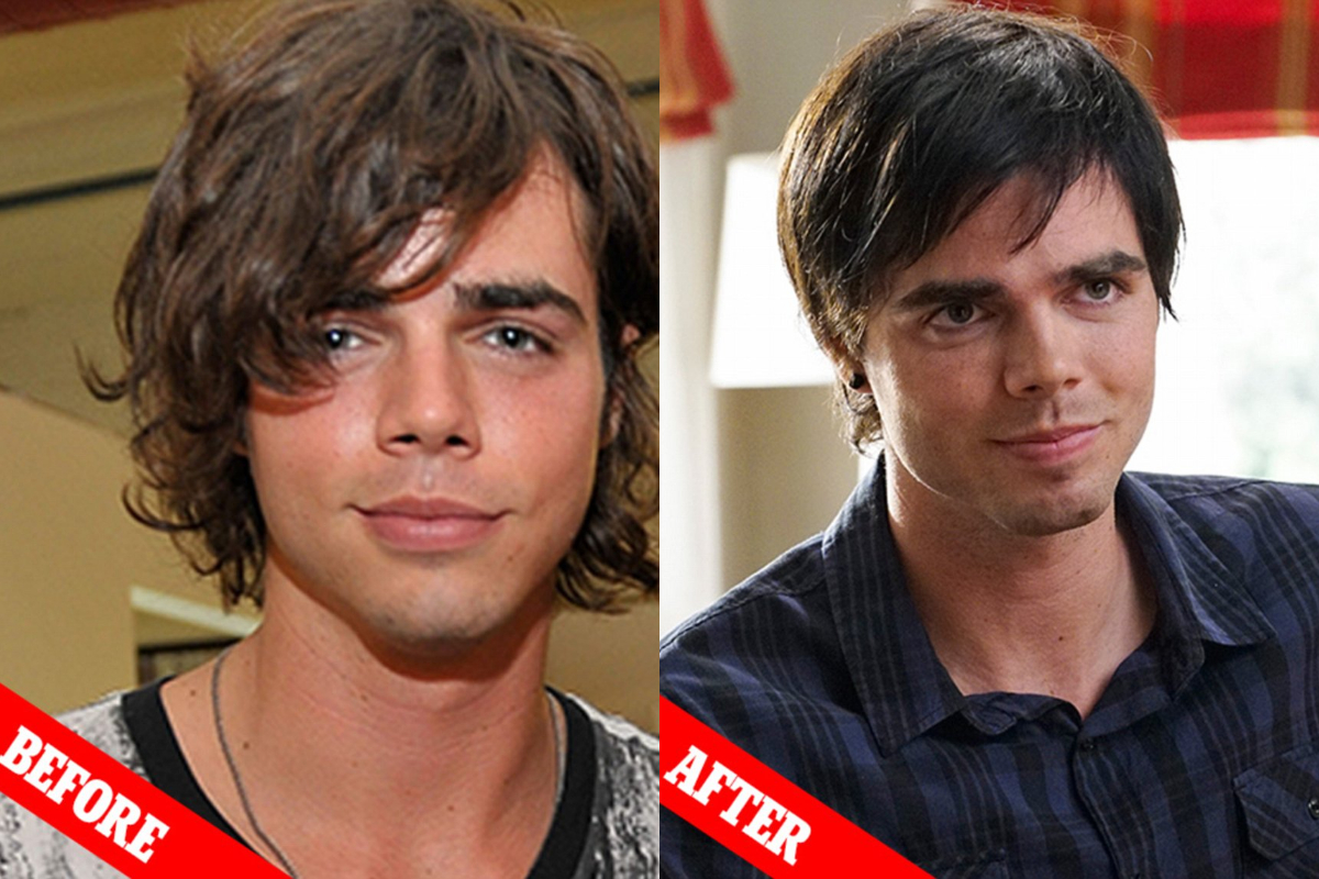When Dylan Reid Ewing revealed his struggles with plastic surgery to ...